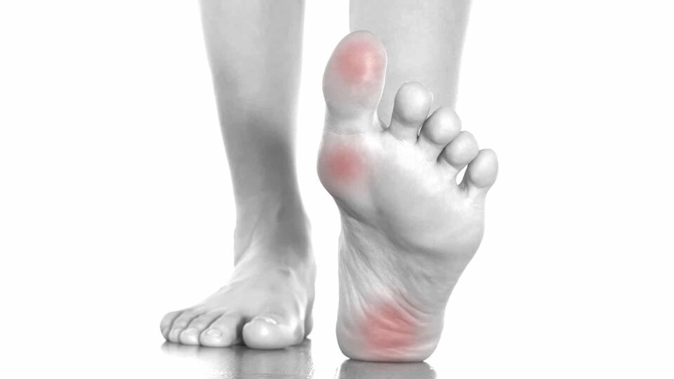 Piede - Mdm Fisioterapia